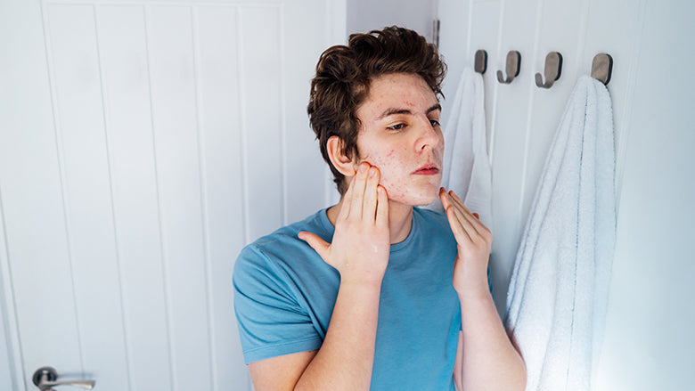 3 things every teenage boy needs in their skin care routine – Green People